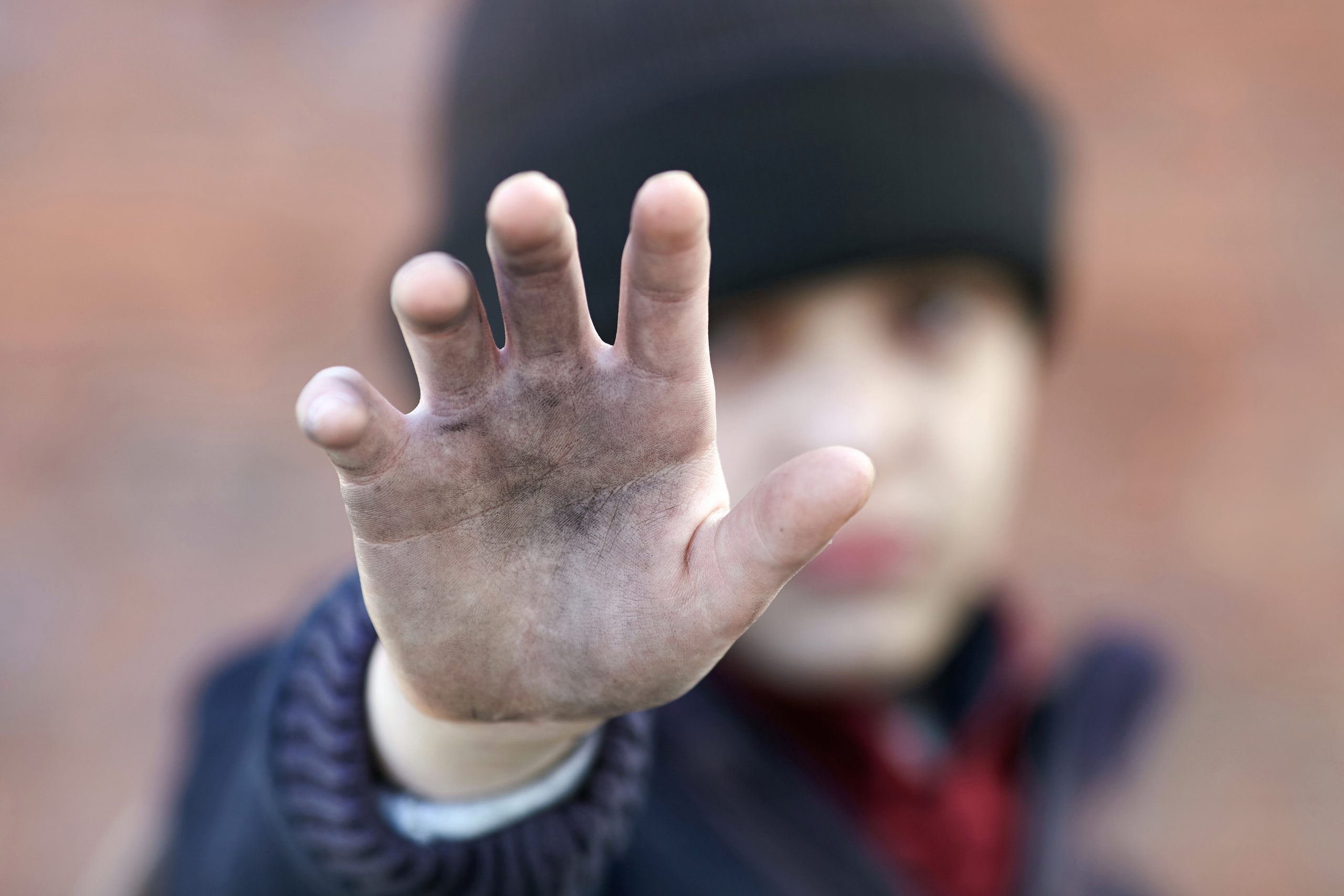 Dramatic,Portrait,Of,A,Little,Homeless,Boy,,Dirty,Hand,,Poverty, - Humanium
