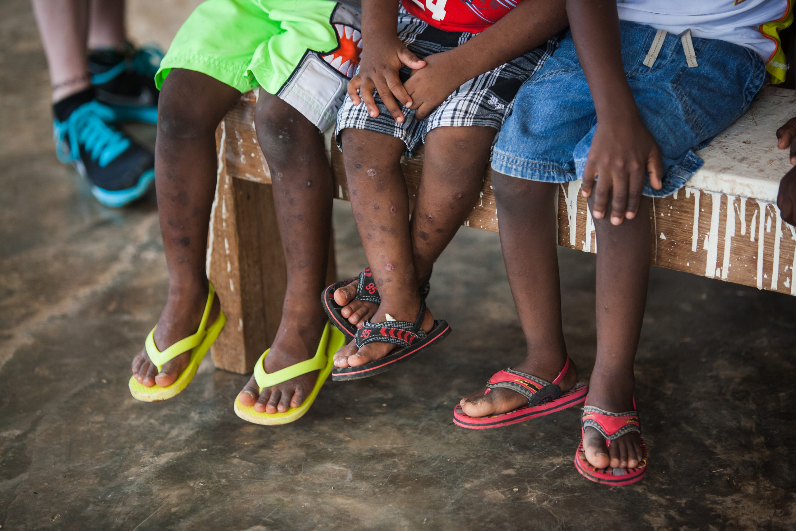 Rising kidnappings of women and children alarm Haiti - Humanium