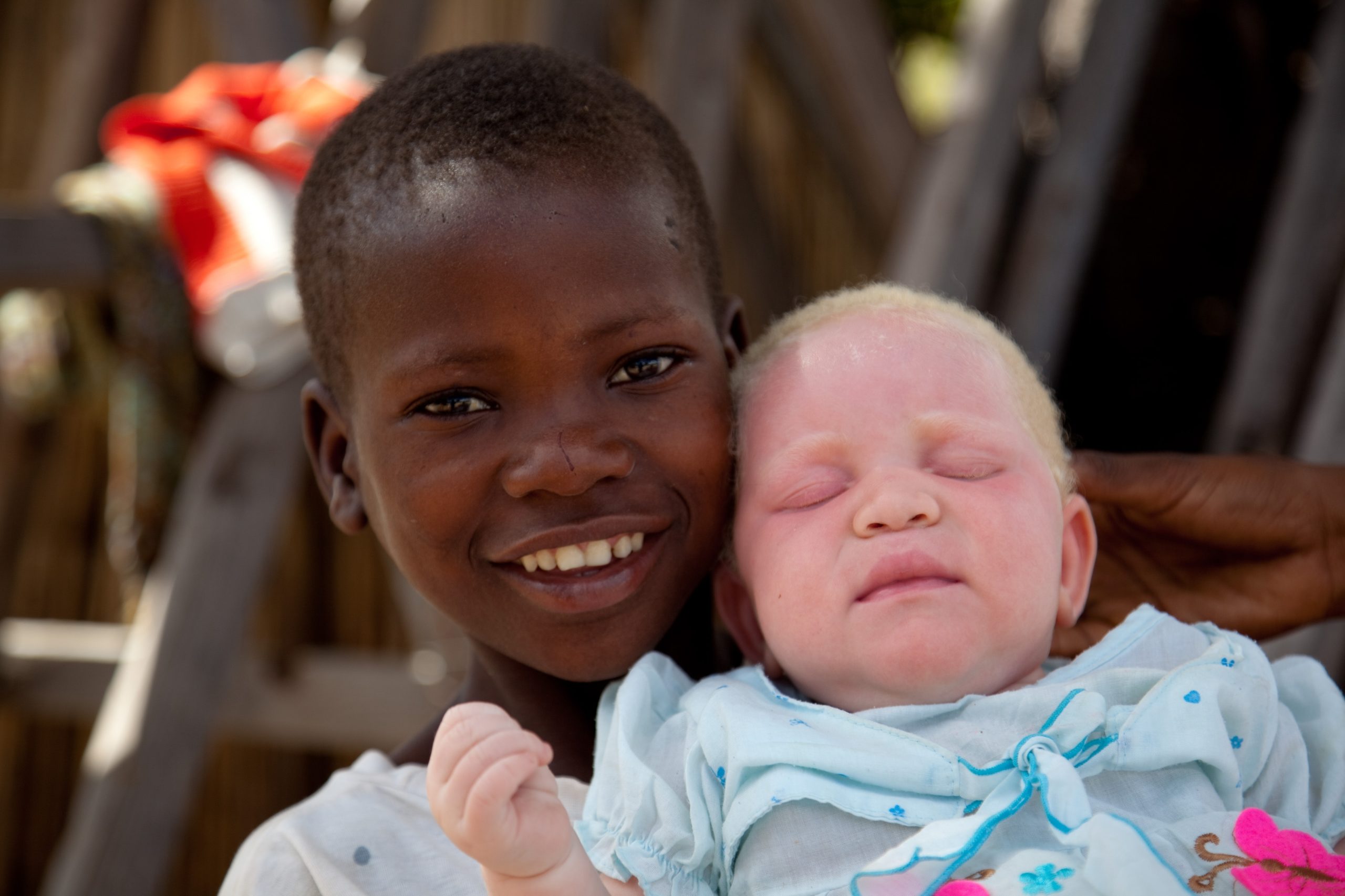 Comment le Mythe de l’Albinos met en danger des enfants tanzaniens ...